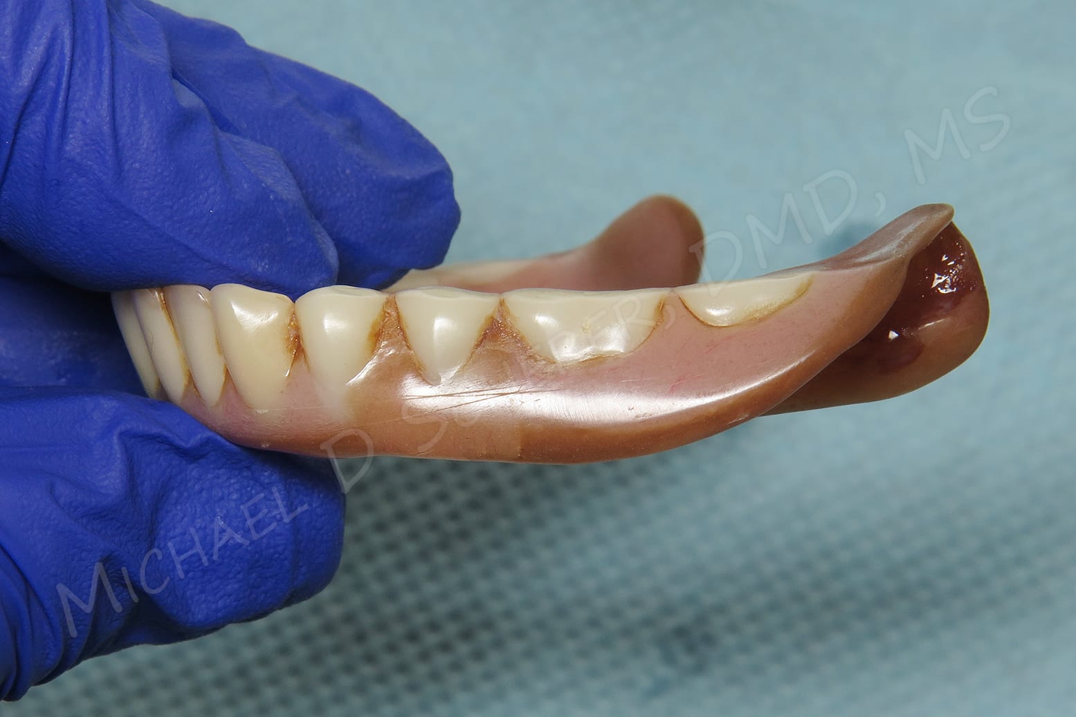 "Nobody Could Exactly Copy My 52-Year Old Denture... Until Now!"