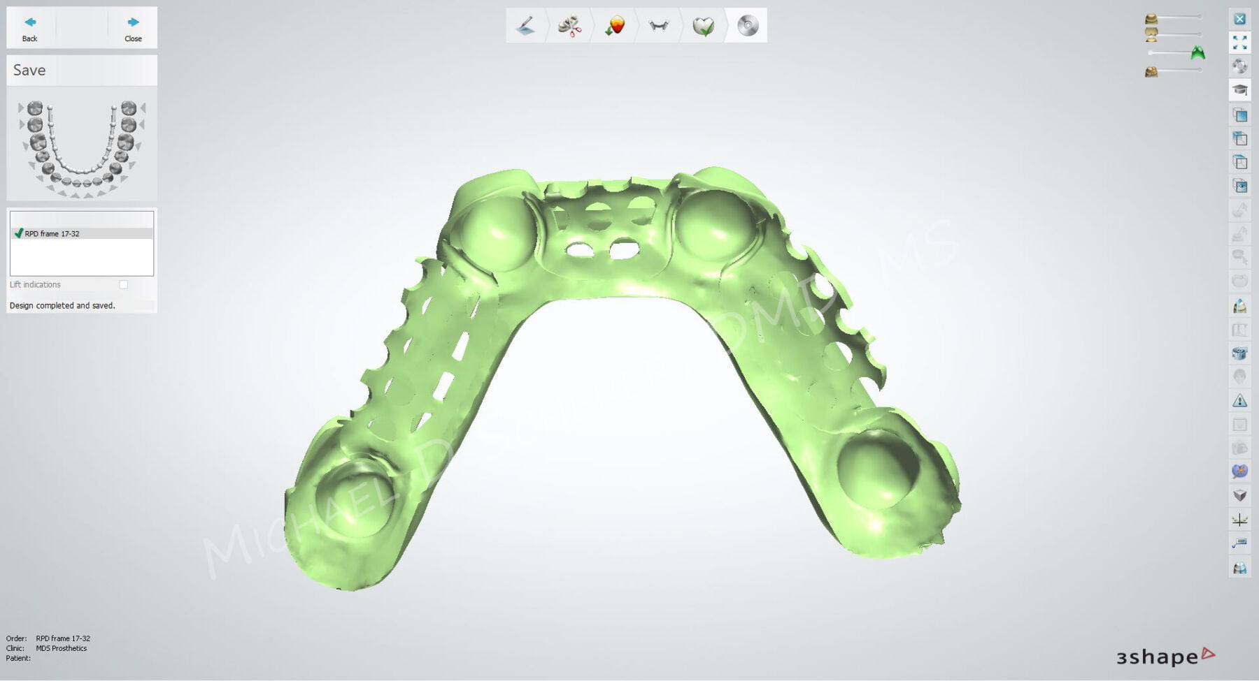 How to Design & Make Affordable Full-Arch Fixed Cases… In Just One ...