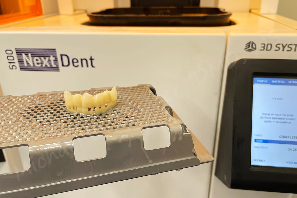 How to Design & 3D Print Your Own In-Office Shell Temps! - LearnDentistry™